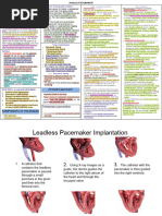 Medtronic Micra Transcatheter Pacing System Patient Brochure | PDF