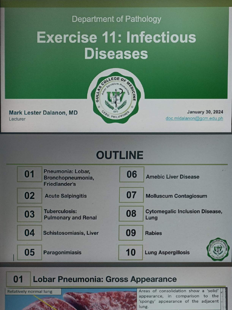 1.Infectious Diseases | PDF