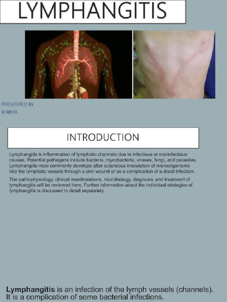 Lymphangitis | PDF
