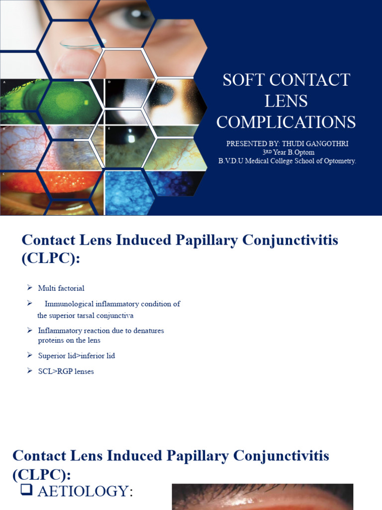 CLPC & Clpu | PDF | Contact Lens | Medical Specialties