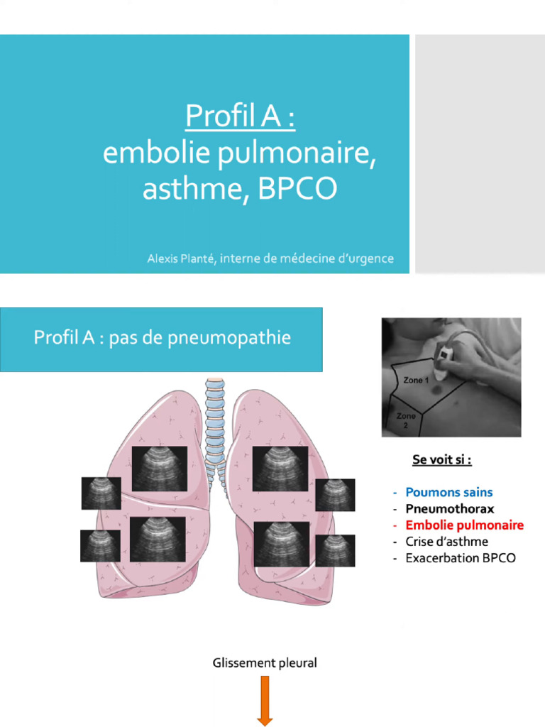 4 Profil A - Embolie Pulmonaire, Asthme Et BPCO | PDF