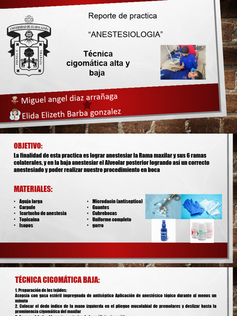 Técnicas de Anestesia Cigomática | PDF