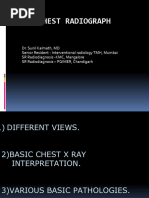 PA vs AP Chest Radiographs Explained | PDF | Radiography | Radiology