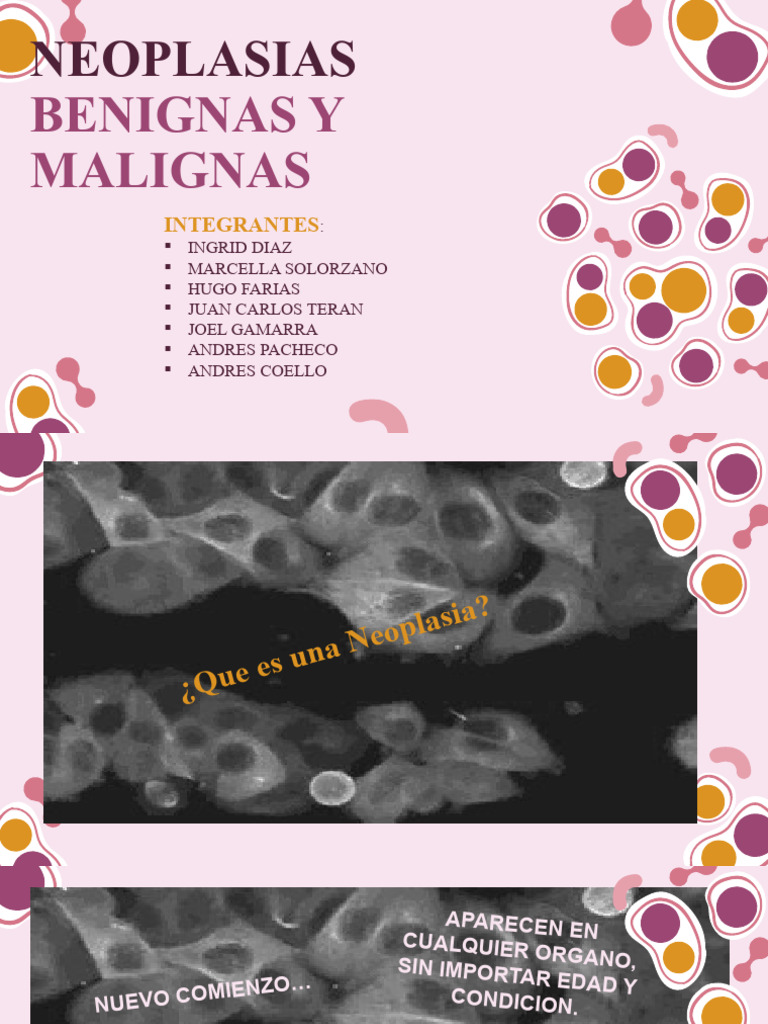 Neoplasias Benignas y Malignas | PDF | Neoplasias | Cáncer