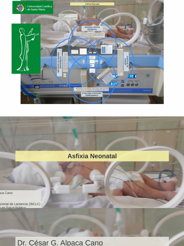 Asfixia Neonatal | PDF