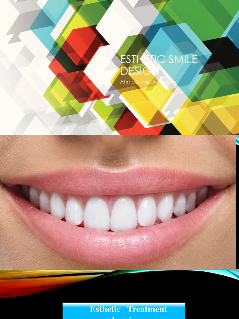 Esthetic smile design | PDF | Tooth | Mouth