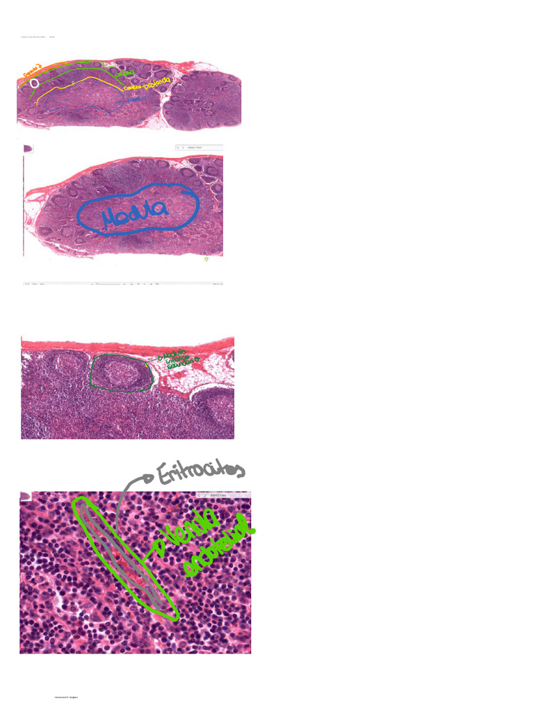 Ganglio Linfatico. Practica. | PDF