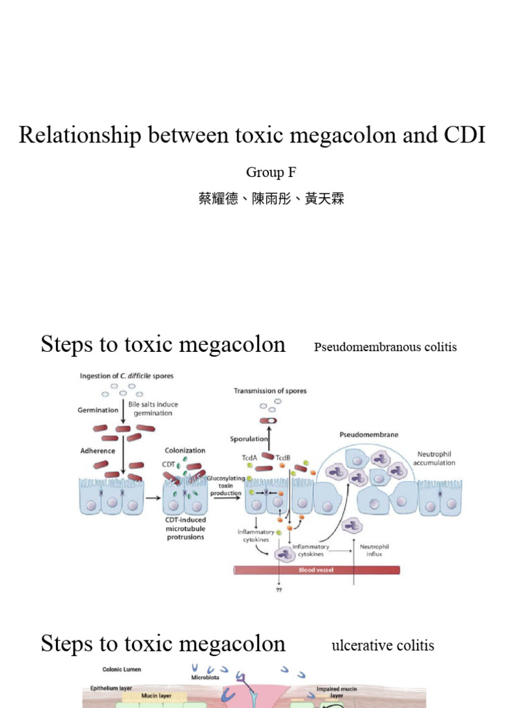 Toxic Megacolon and Clostridium Difficile | PDF | Medical Specialties ...
