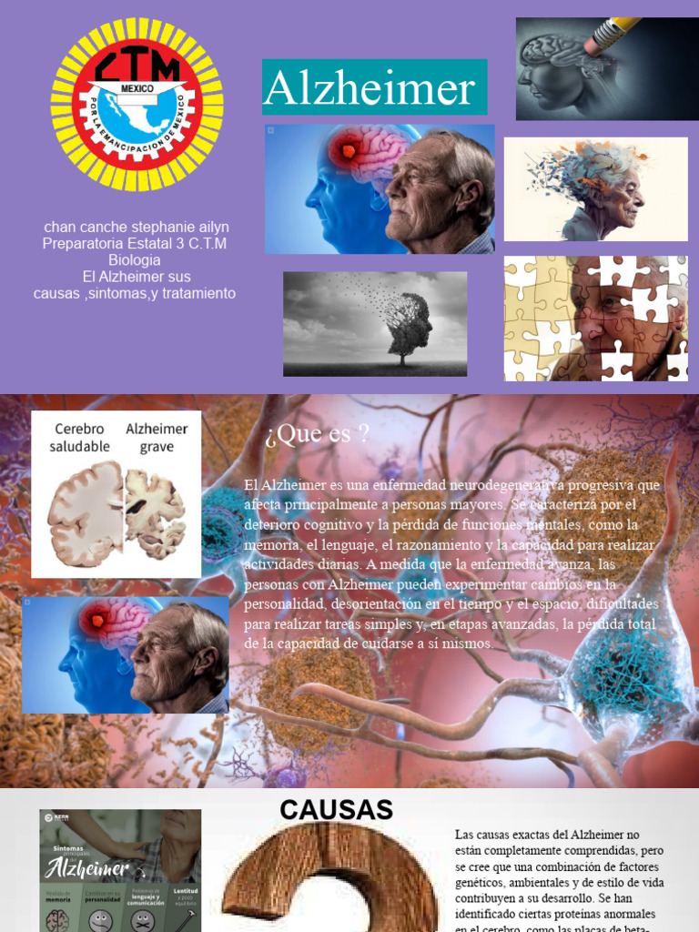 Alzheimer | PDF | Enfermedad de Alzheimer | Medicina CLINICA