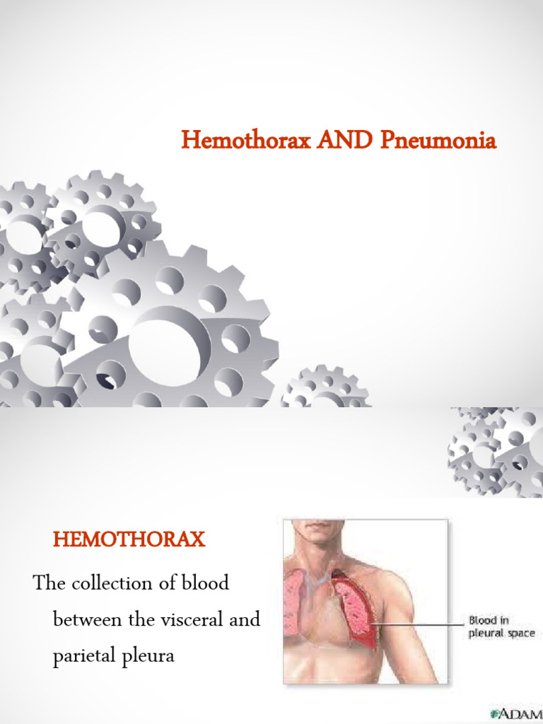 Hemothorax AND Pneumonia | PDF | Pneumonia | Lung