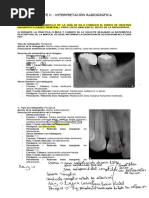 Anatomía y Límites de la Región Maseterina | PDF | Cabeza y cuello ...