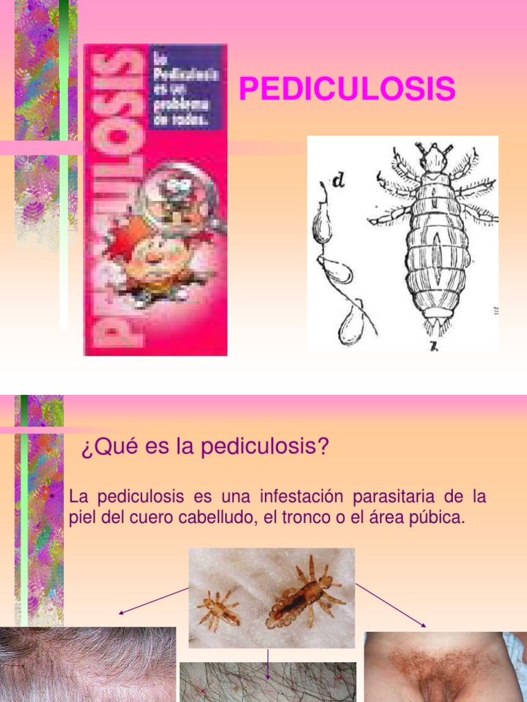 Guía Completa sobre Pediculosis | PDF | Especialidades Medicas | Enfermedades y trastornos