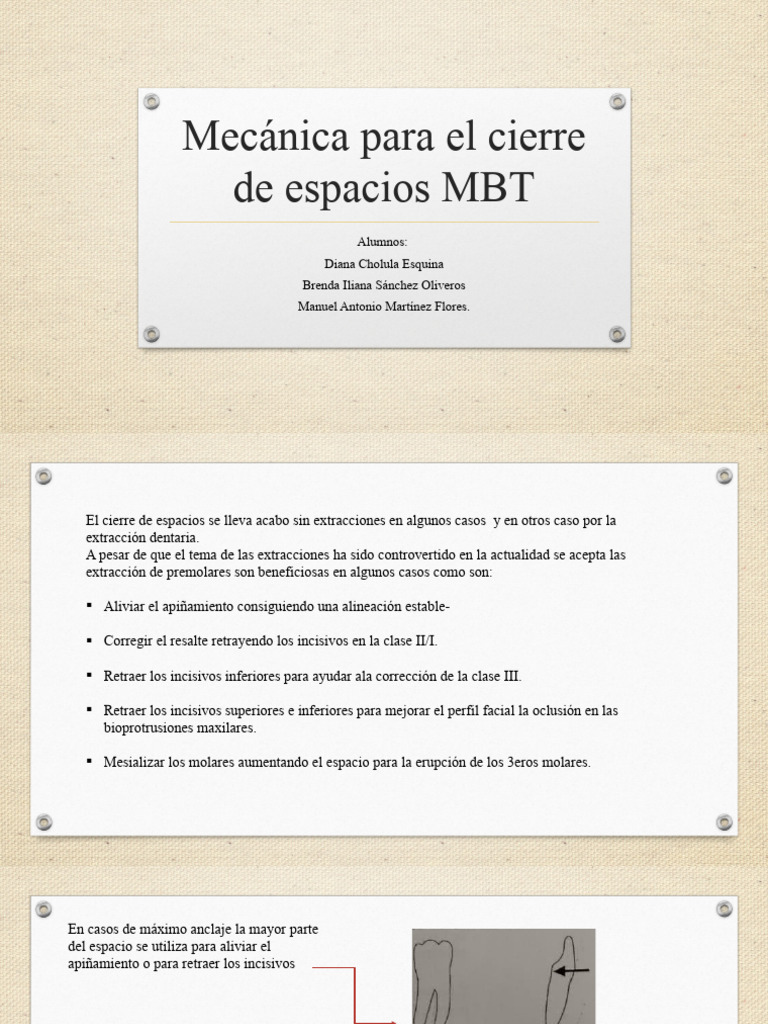 Expo Mecanica para El Cierre de Espacios MBT | PDF | Ortodoncia | Anatomia dental