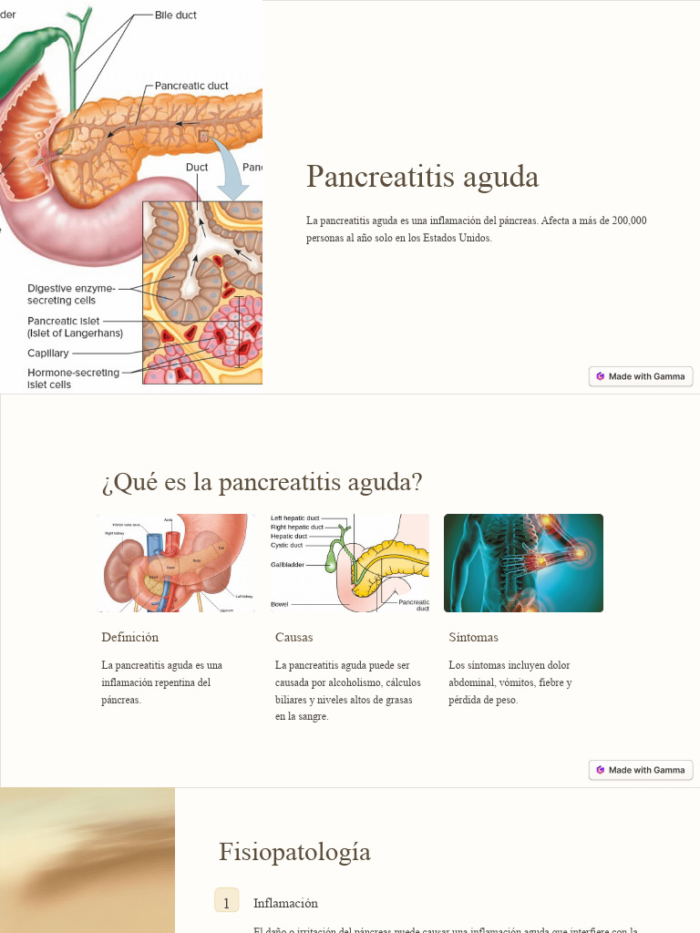 Pancreatitis Aguda: Causas y Tratamiento | PDF | Enfermedades y ...