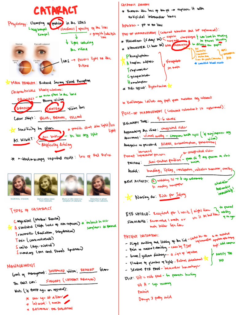 Cataract - Glaucoma | PDF | Glaucoma | Cataract