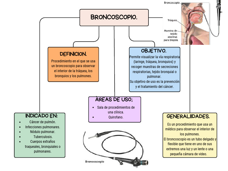 Broncoscopia: Diagnóstico y Tratamiento | PDF