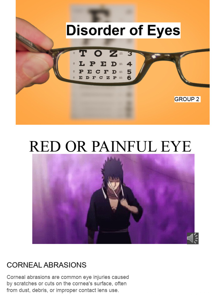 Visual Problem and Disorders 1 | PDF | Human Eye | Ophthalmology