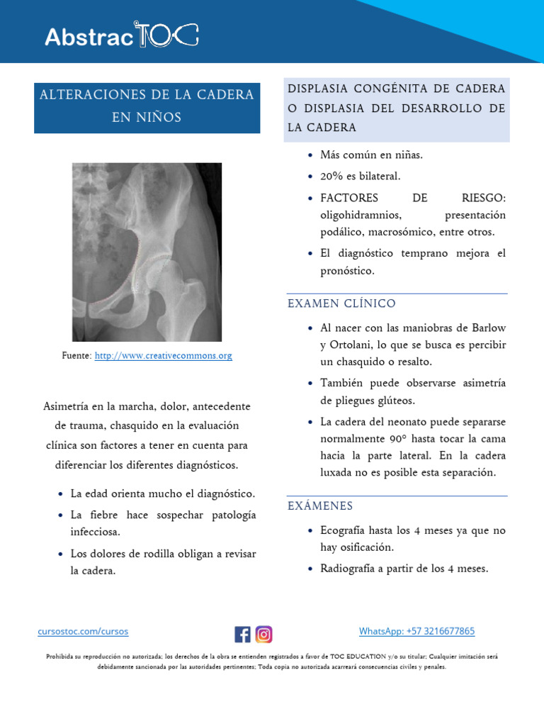 Alteraciones de Cadera en Niños: Diagnóstico y Tratamiento | PDF ...