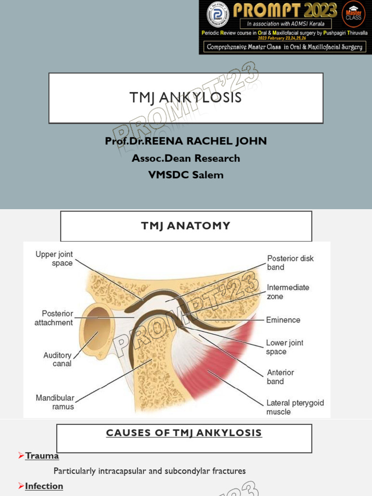TMJ Ankylosis | PDF | Bone | Skull