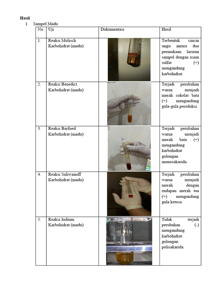Hasil Percobaan 3 Lipid Dan Karbohidrat | PDF | Sains & Matematika