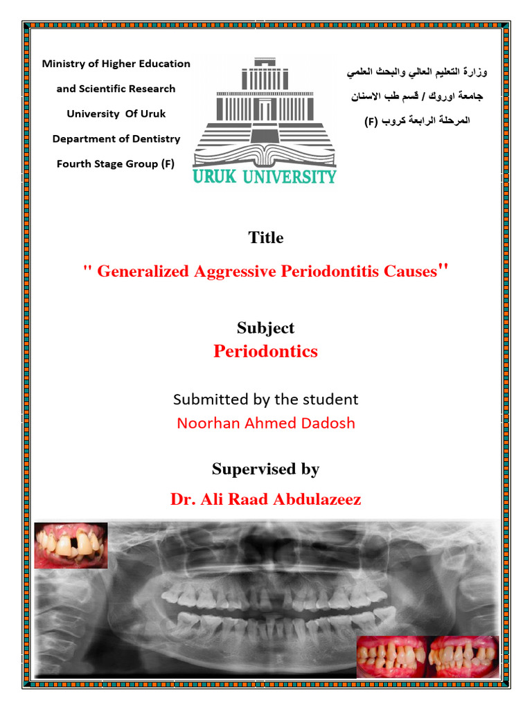 Generalized Aggressive Periodontitis Causes | PDF | Periodontology ...