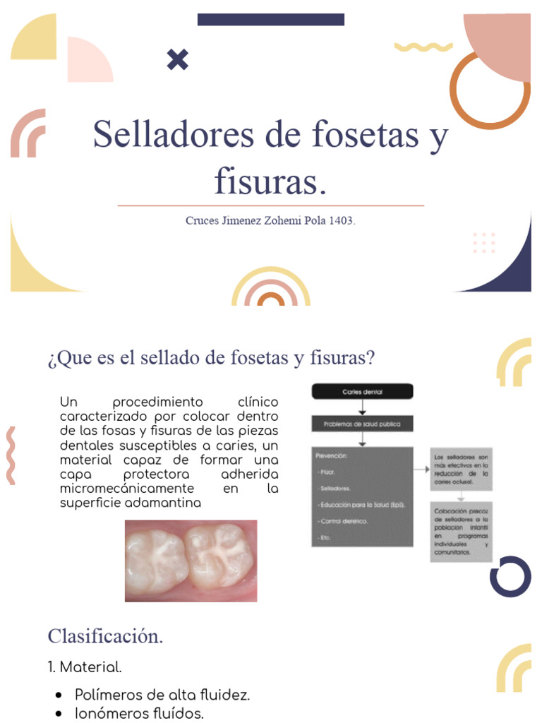 Selladores de Fosetas y Fisuras. | PDF | Diente | Esmalte de dientes