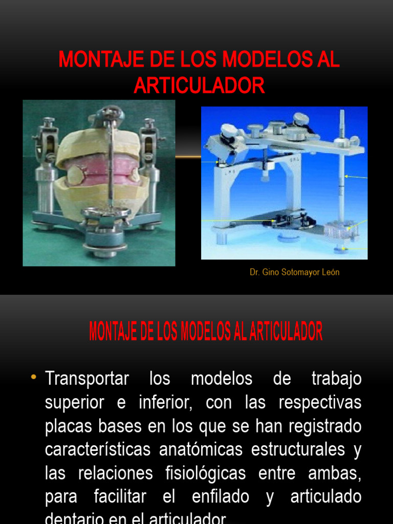 Montaje de Los Modelos Al Articulador | PDF Montaje de Los Modelos Al Articulador | PDF