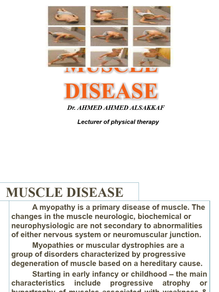 Muscle Disease ٠٥١٥٢٧ | PDF | Muscular Dystrophy | Musculoskeletal System
