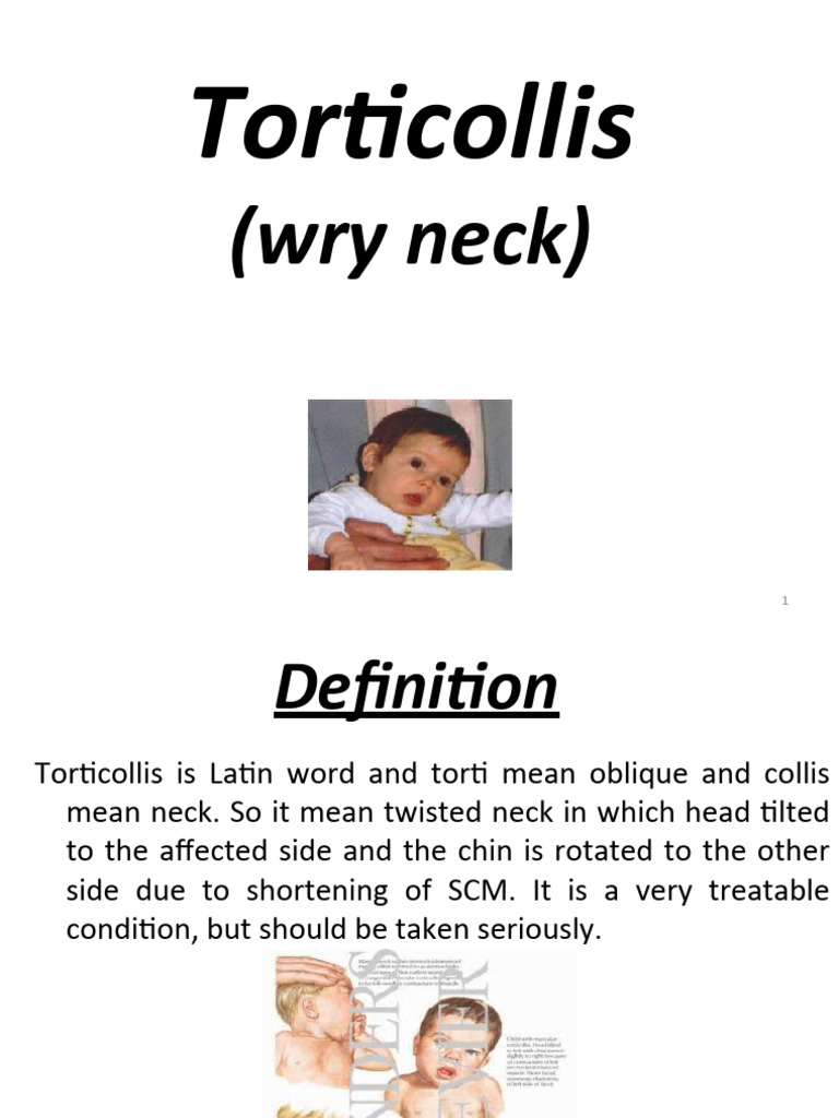 Torticollis ٠٥١٥٢٠ | PDF | Musculoskeletal System | Human Anatomy