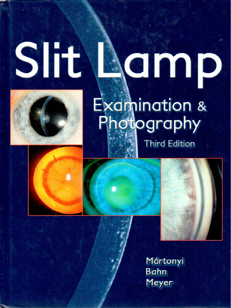 Slit Lamp Examination and Photography | PDF | Human Eye | Optics