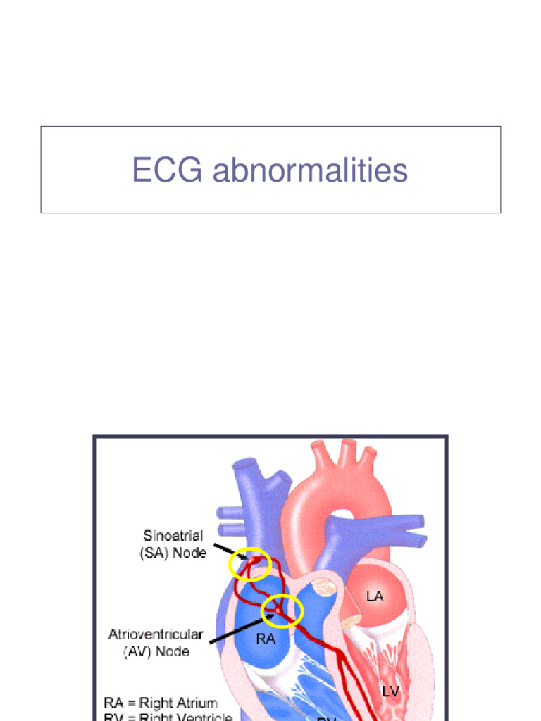 Cardiology - ECG WORKSHOP | Download Free PDF | Electrocardiography | Atrium (Heart)