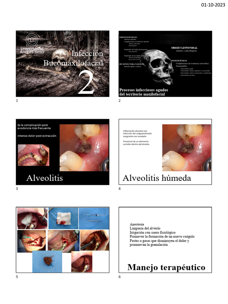 Infección Bucomaxilofacial 2 | PDF | Causas de la muerte | Inmunología