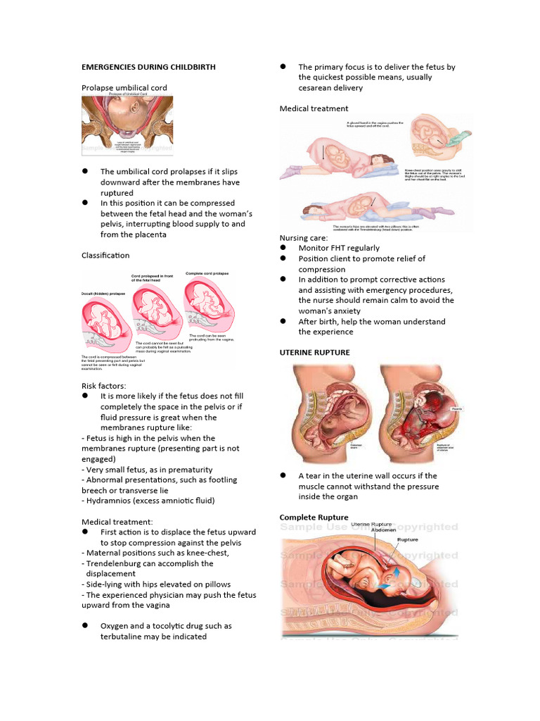 Childbirth Emergency Management Guide | PDF | Childbirth | Uterus