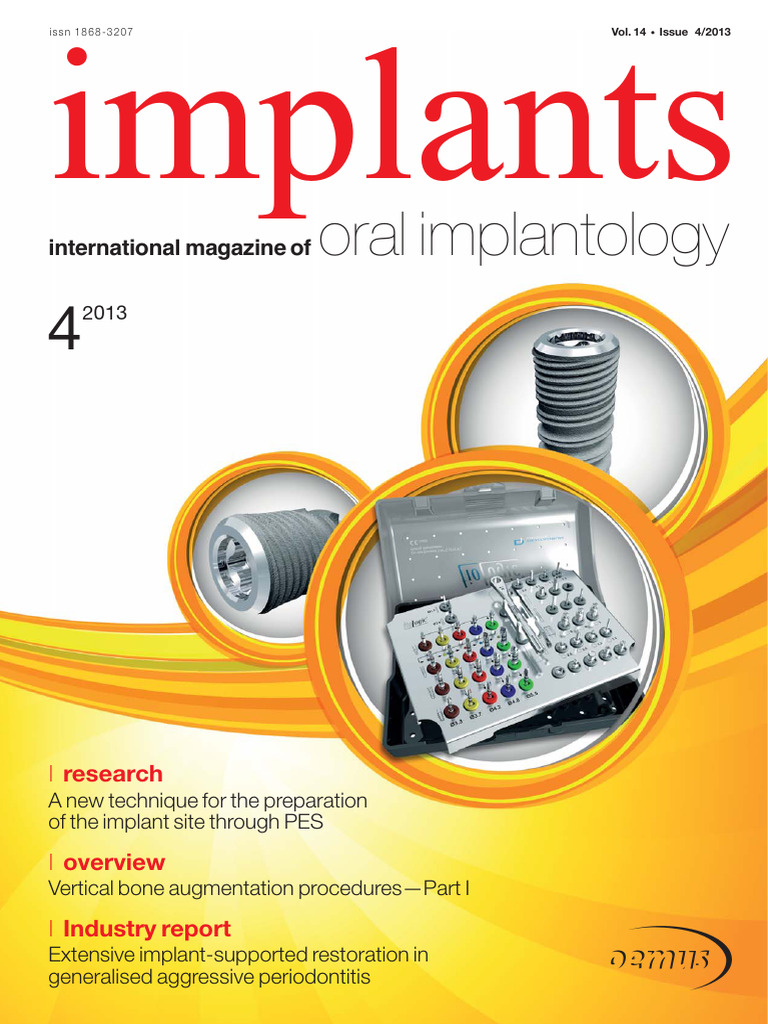 Implants InterationalN4 13 | PDF | Dental Implant | Surgery