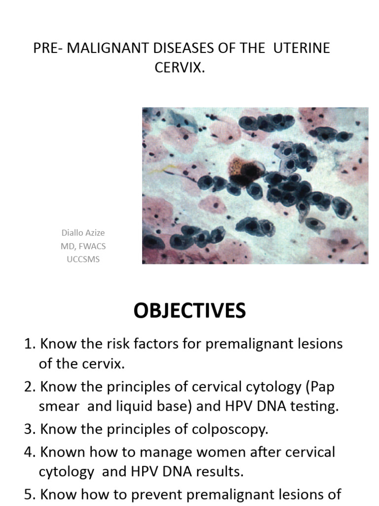 2021 Intraepithelial Neoplasia and Carcinoma of The Cervix ( | Download ...