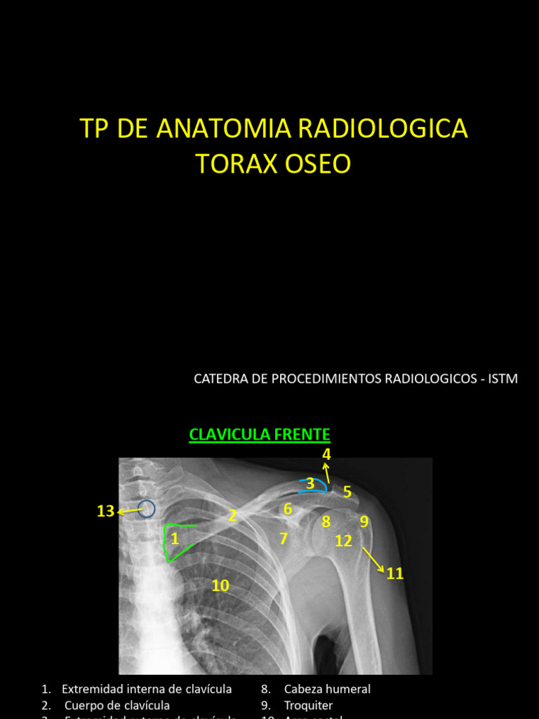 TP Correccion Anatomia Radiologica Torax Oseo | PDF | Tórax | Tórax ...