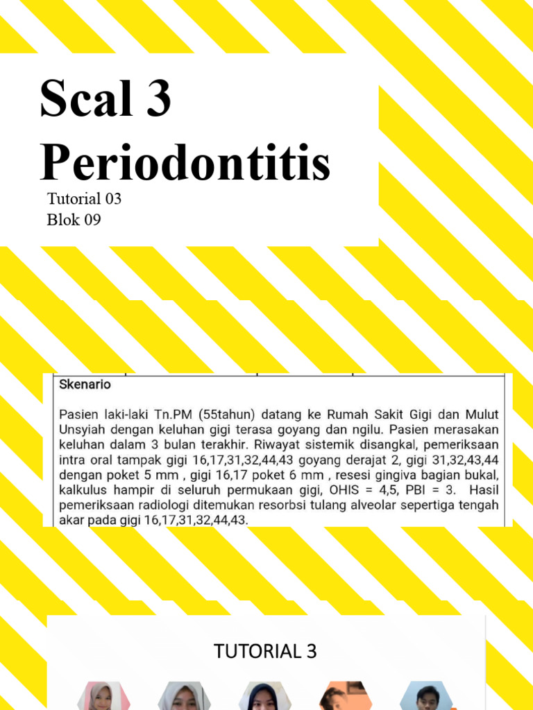 Scal 3 Periodontitis Tutorial 3 | PDF