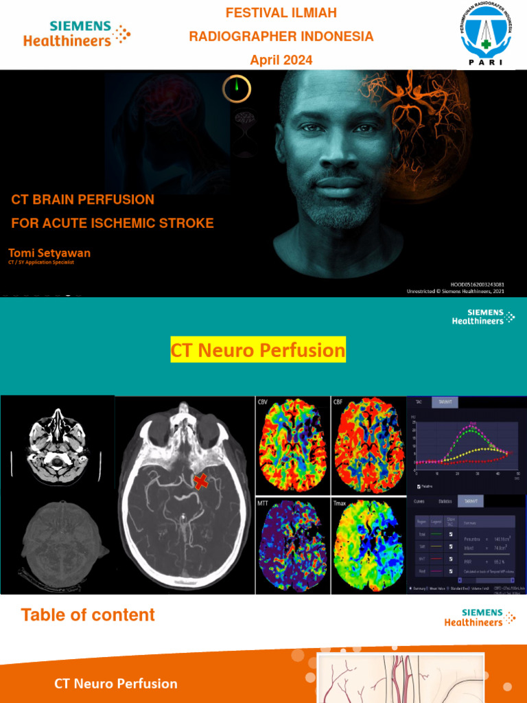 Materi Narsum 1 Tomi Setyawan, S.ST | PDF | Stroke | Speech