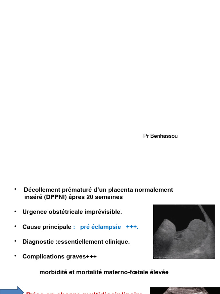 Décollement Prématuré du Placenta | PDF | Accouchement | Grossesse