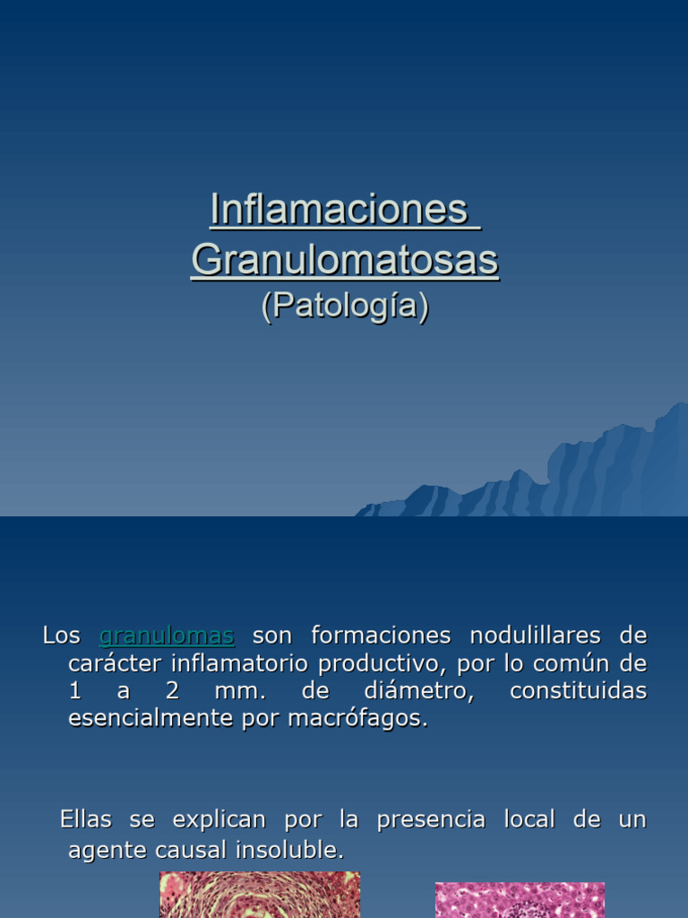 Inflamaciones Granulomatosas | Descargar gratis PDF | Inflamación ...