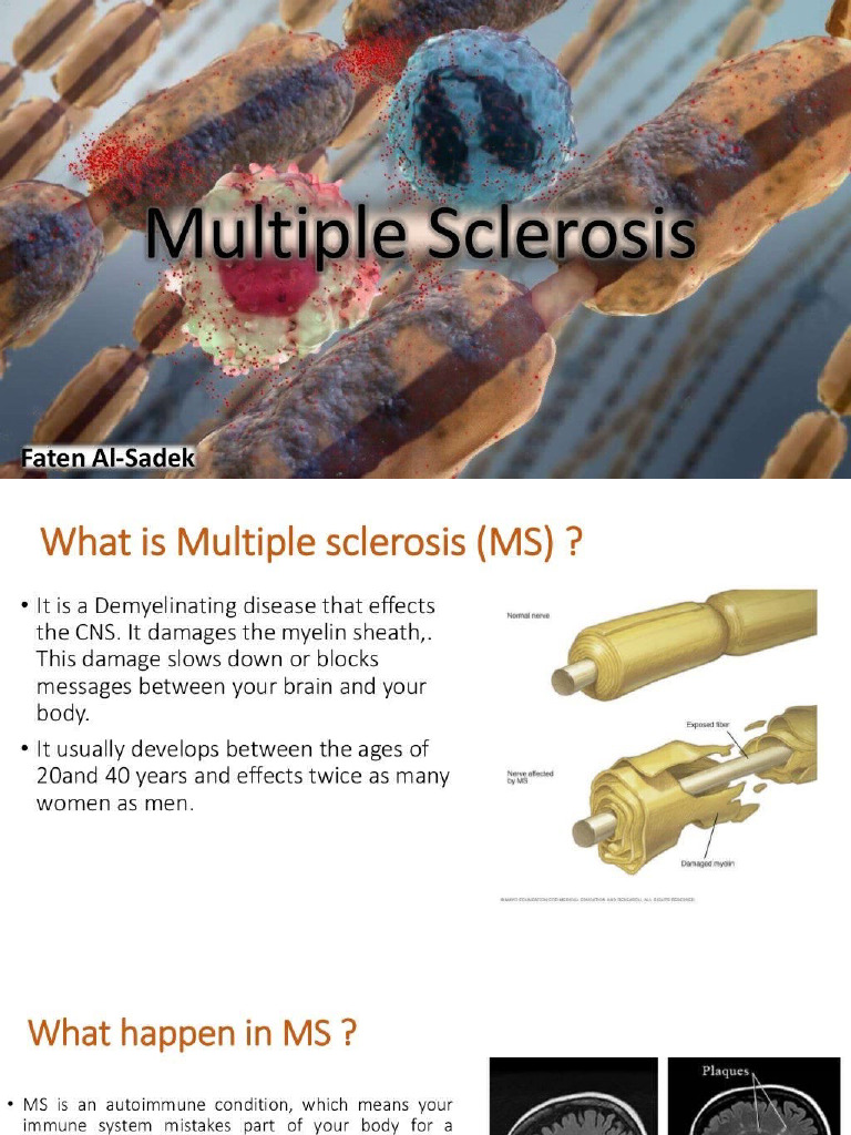 Multiple Sclerosis Pathophysiology Diagnosis and Treatment | PDF