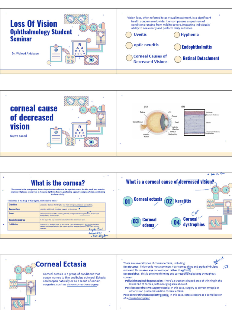 9) Loss of Vision (Seminar) | PDF | Cornea | Human Eye