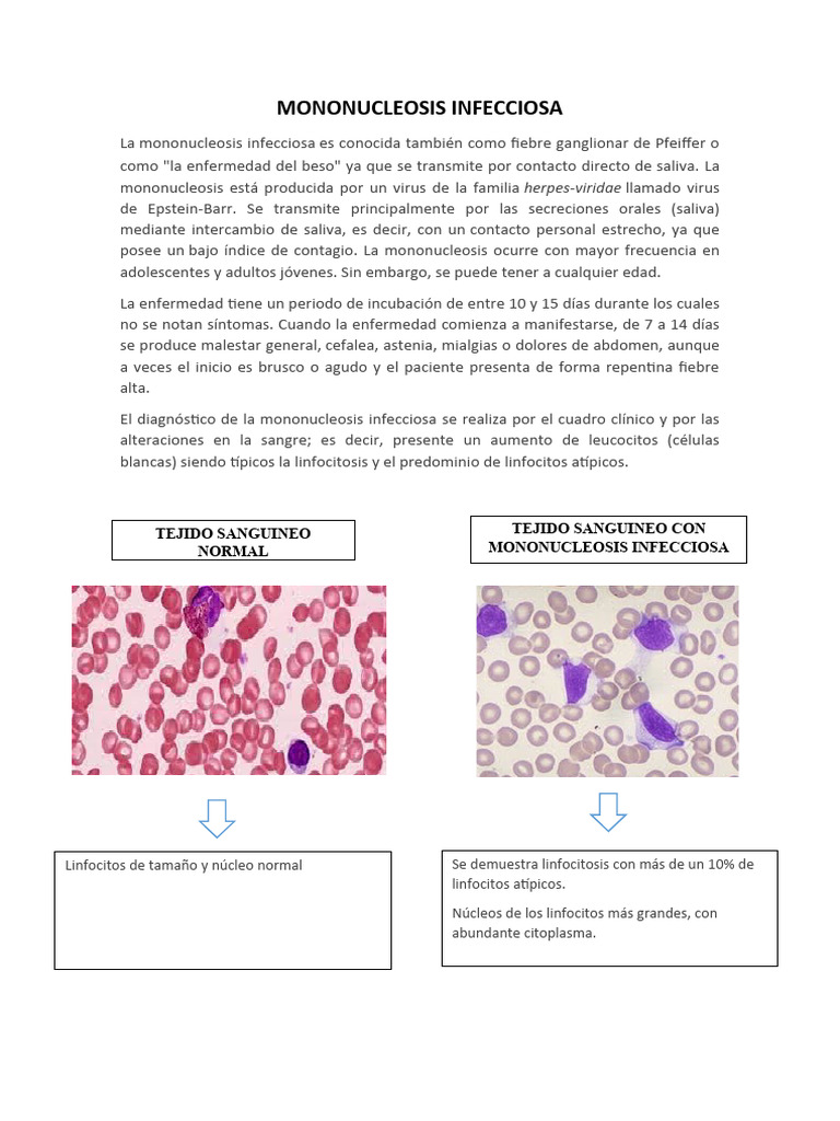Mononucleosis: Guía para Jóvenes | PDF