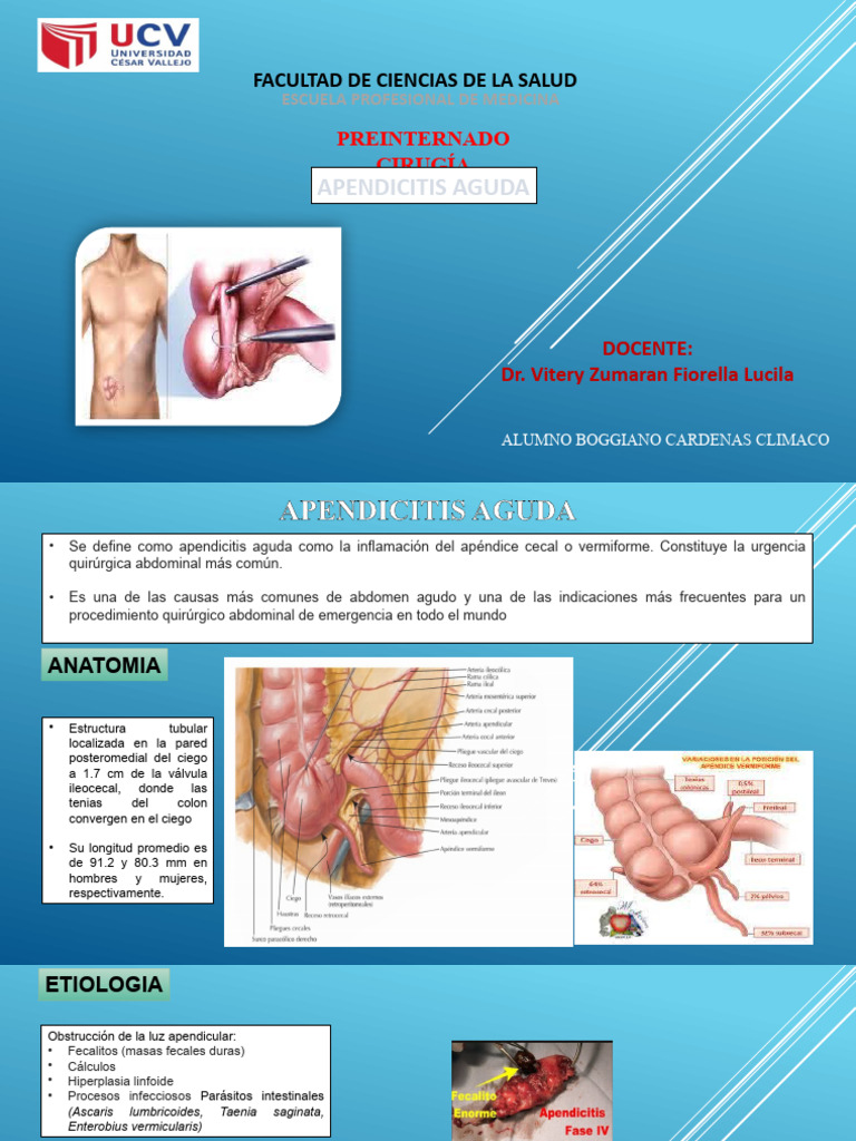 APENDICITIS AGUDA | PDF | Enfermedades y trastornos | Medicina