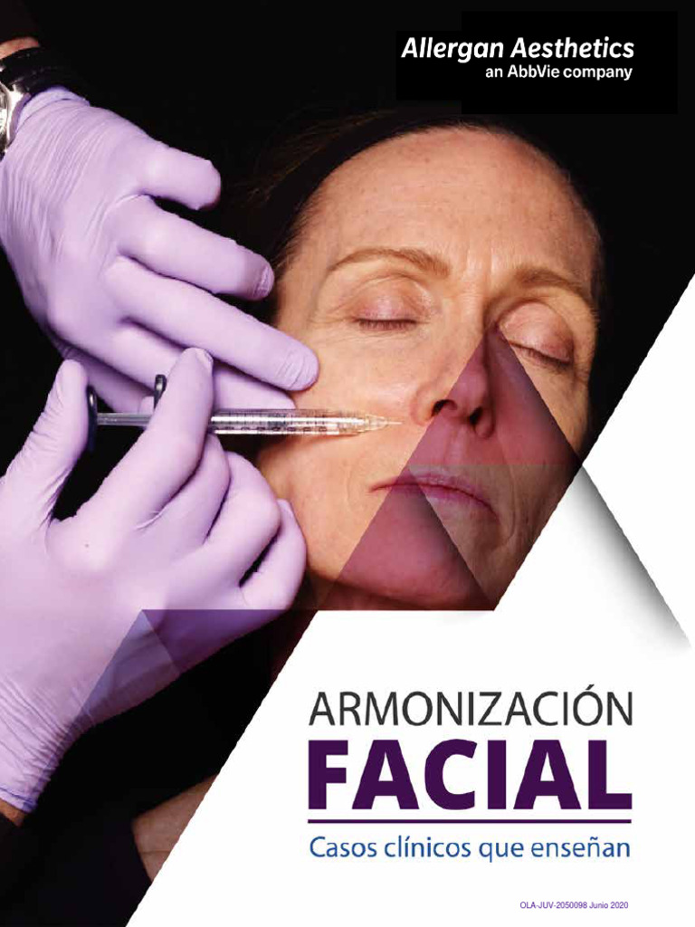 Libro Armonización Facial ALLERGAN | PDF | Cara | Cabeza y cuello humanos