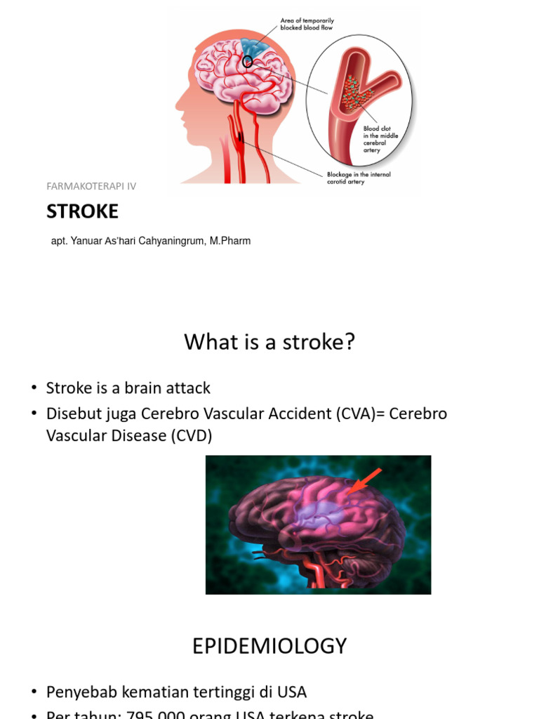 Stroke Tia | PDF | Stroke | Aspirin