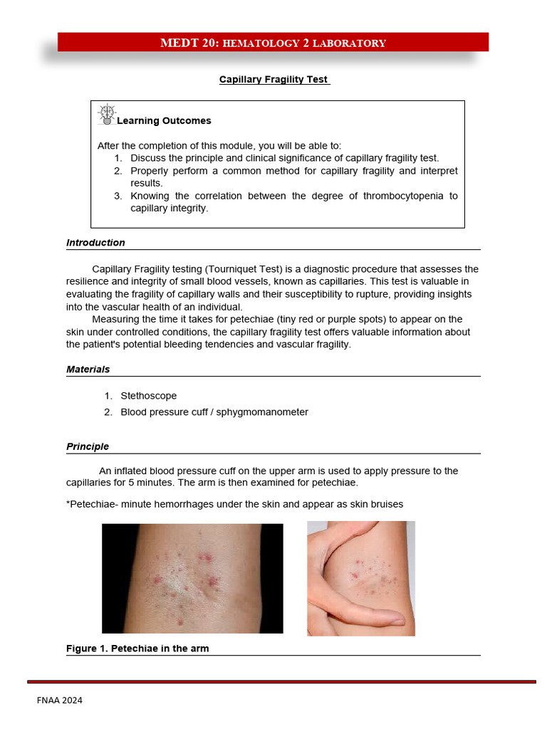 2 Hema 2 Laboratory Manual-Capillary Fragility Testing | Download Free ...