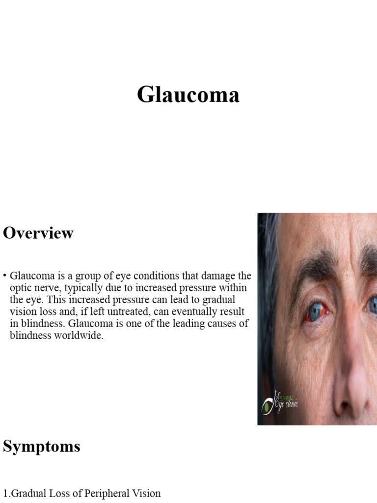 Glaucoma | PDF