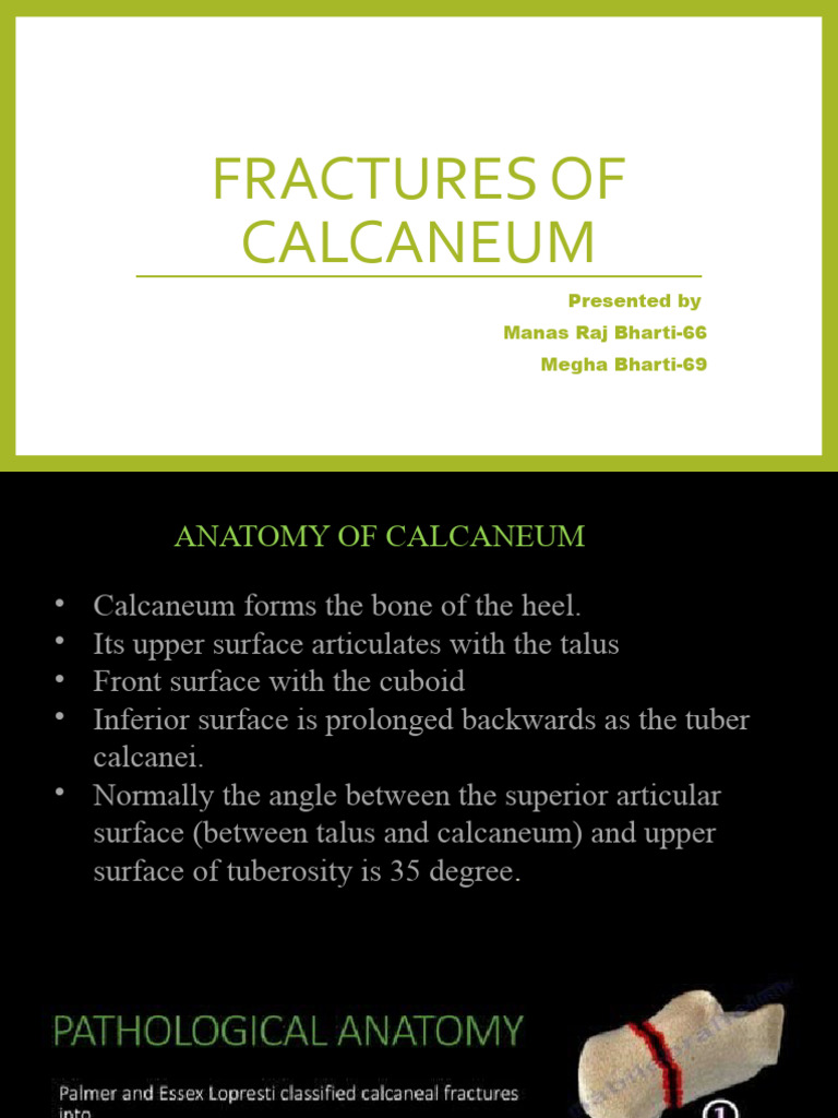 Calcaneum Fracture Overview | PDF