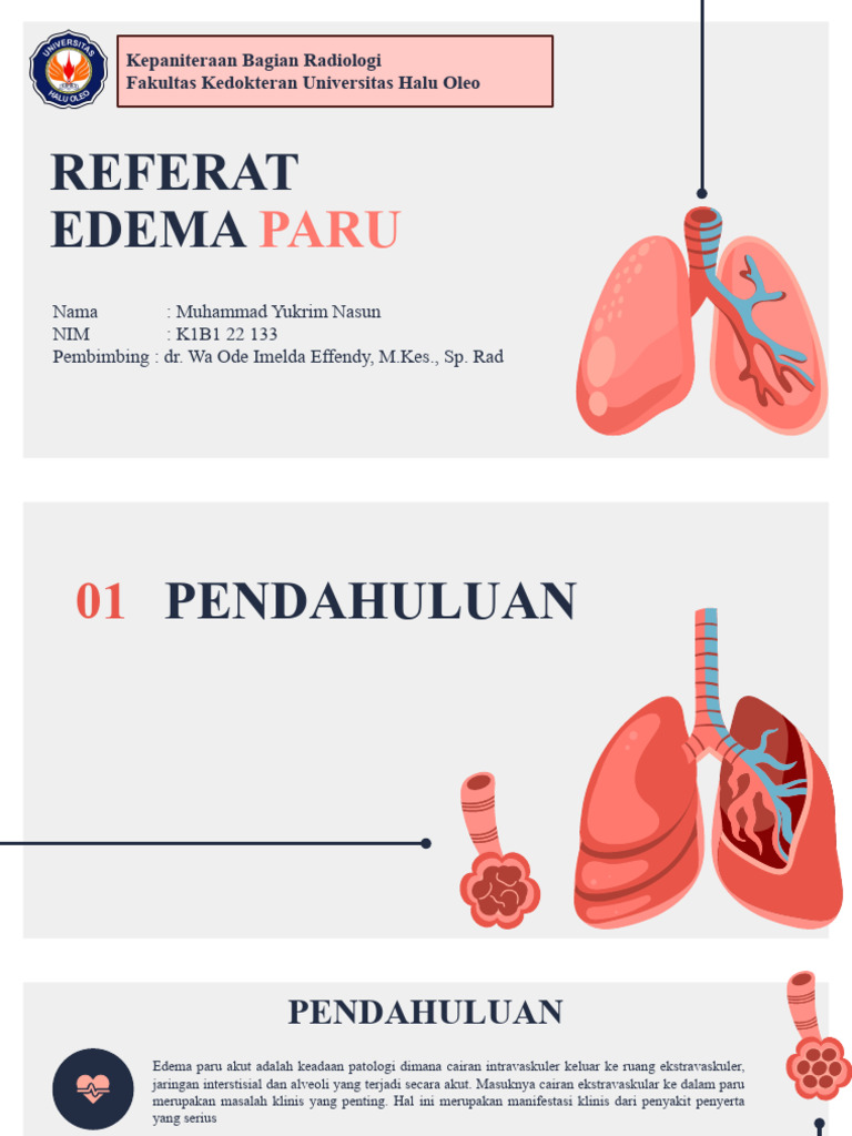 Radiologi Edema Paru - Muhammad Yukrim Nasrun - K1B122133 | PDF
